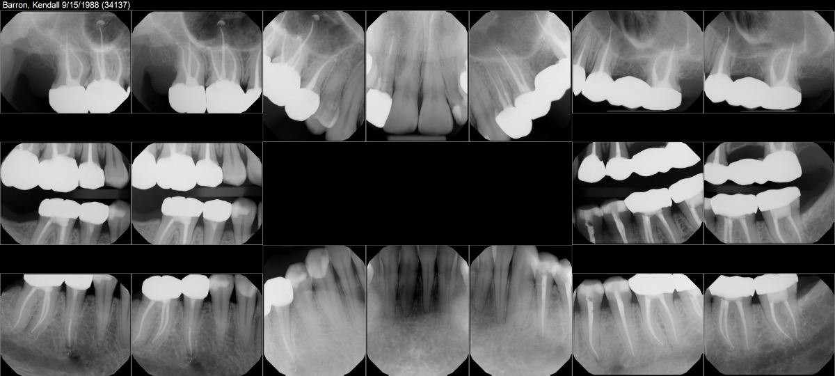 *NewTeethForKendall - Fundraiser by Kendall Barron on *spotfund