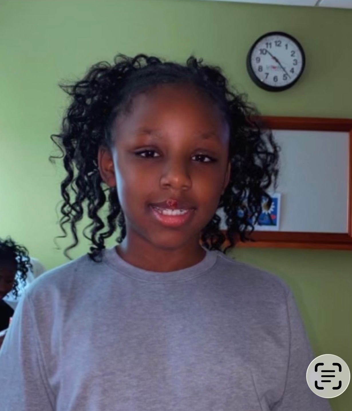 *HelpHaileyHealAfterATer - Fundraiser by April Valentine on *spotfund