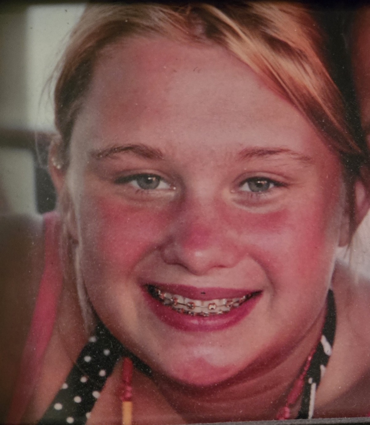 *HelpReneeRecover - Fundraiser by Beverly Bubner on *spotfund